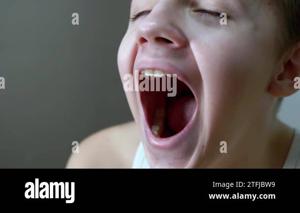 Close-up Face of a Yawning Sleepy Tired Child with a Wide-Open Mouth ...