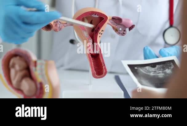 Gynecologist shows anatomy of uterus and ultrasound of ovaries to ...