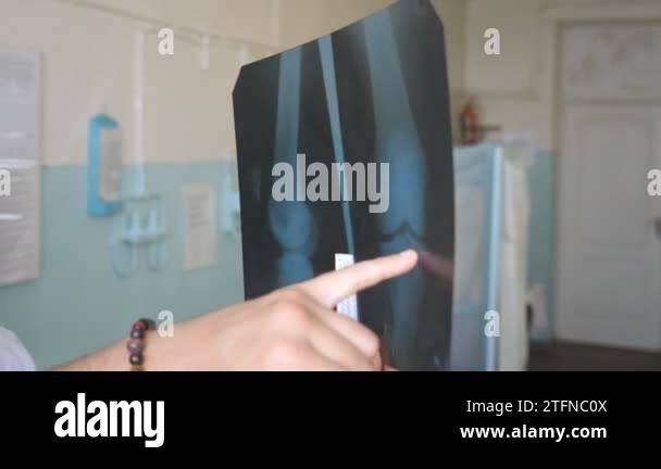 Two caucasian doctors view mri picture and discussing about it. Medical ...