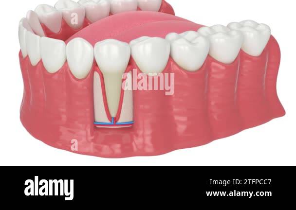 Human jaw with intraligamentary anesthesia procedure Stock Video ...