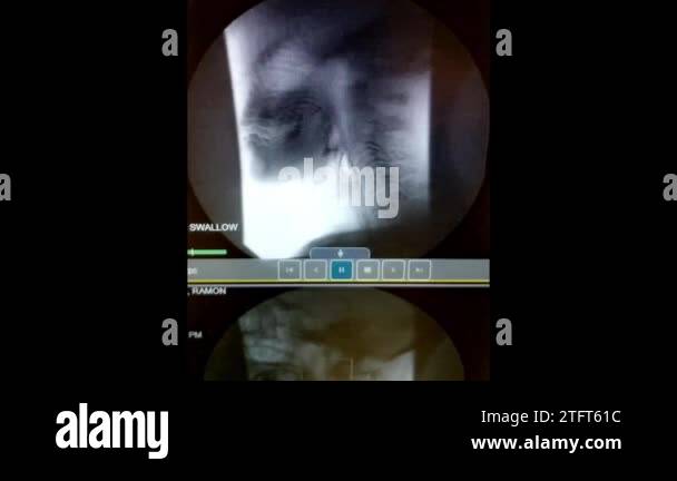 Voice Box Anatomy Stock Videos Footage Hd And 4k Video Clips Alamy