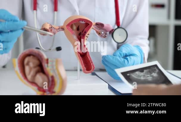 Doctor showing patient diseases of female reproductive system on ...