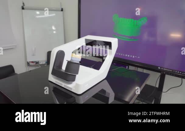 Dental office interior. Scanner 3d models of teeth Stock Video Footage ...