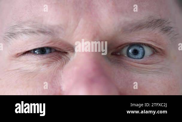 Tic disorder Stock Videos & Footage - HD and 4K Video Clips - Alamy