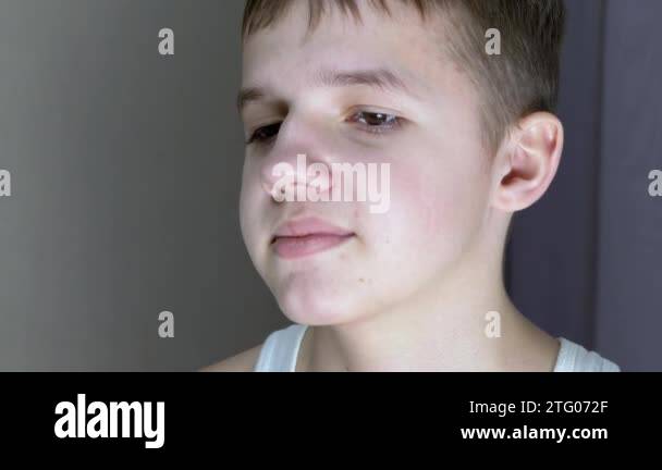 Close-up Face of an Embarrassed Shy Teenager with Downcast, Blinking ...