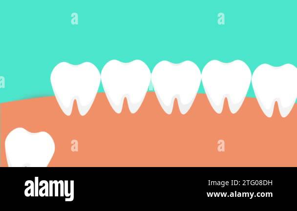 Tooth pushing from the inside and giving pain to the gum 4K animation ...