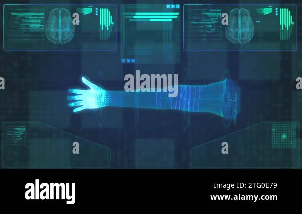 Hand injury Stock Videos & Footage - HD and 4K Video Clips - Alamy