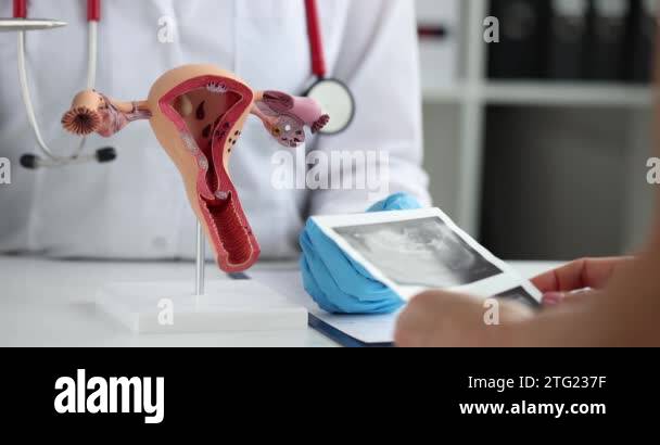 Gynecologist consults woman with ultrasound scan of uterus ...