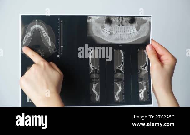 Doctor showing a CT scan of a patient with temporomandibular joint ...