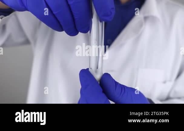 Medical laboratory assistant checks a test tube with sperm. Spermogram ...