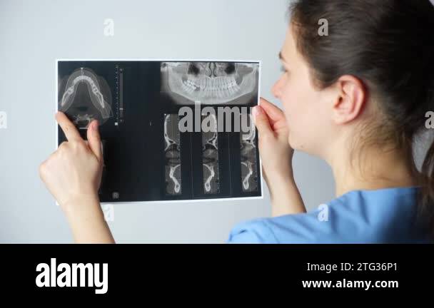 Doctor showing a CT scan of a patient with temporomandibular joint ...