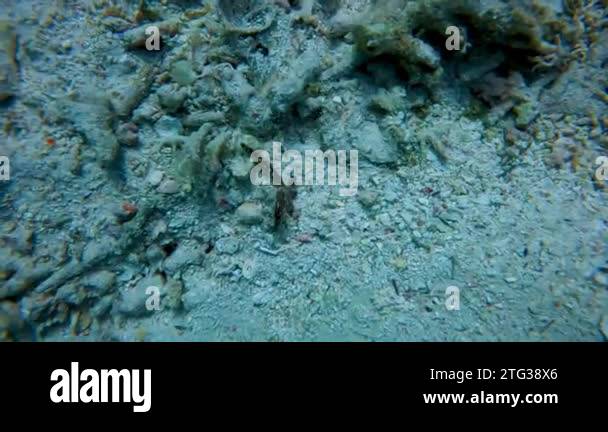 Missing arms Stock Videos & Footage - HD and 4K Video Clips - Alamy