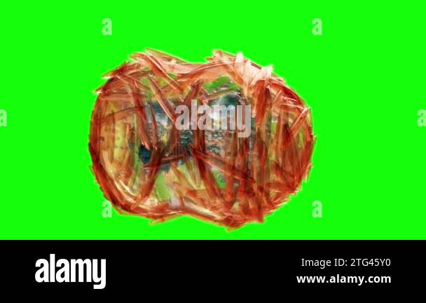 Monkeypox infection pandemic. monkeypox cell, symptoms or precautions ...