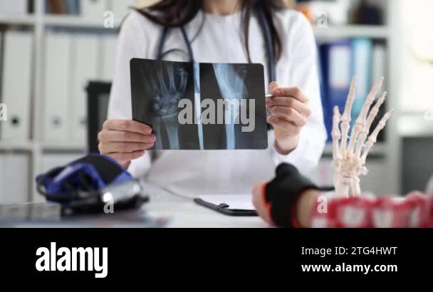 Doctors point to x-ray medical imaging with hand bone disease ...