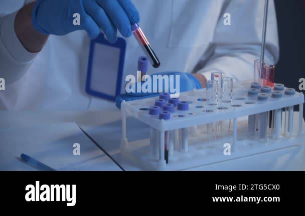 Pathologist working in lab with blood samples. Scientist processing DNA ...