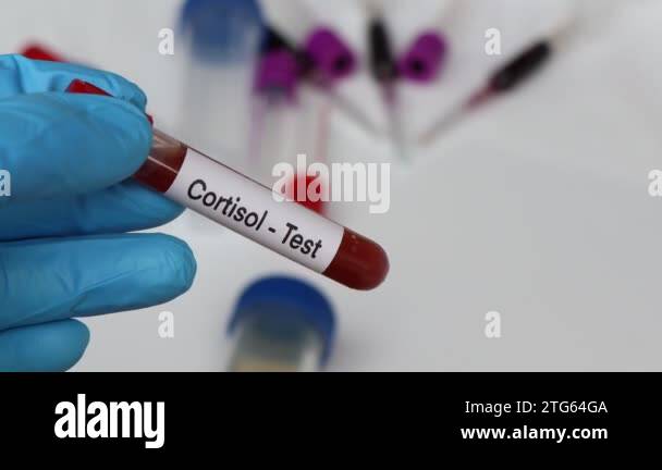 Cortisol test to look for abnormalities from blood, blood sample to ...