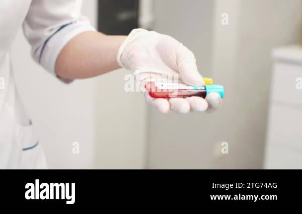 Mixing blood in test tubes. Inverting test tubes with blood. Prevent ...