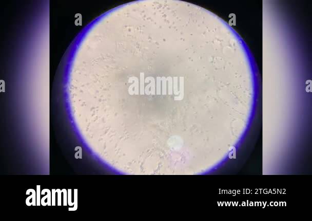 Human Sperm Under Microscope 40x Magnification Macro View Through