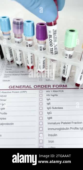 Blood test tube study Stock Videos & Footage - HD and 4K Video Clips ...