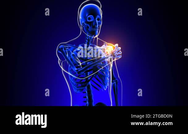 Shoulder joint pain Stock Videos & Footage - HD and 4K Video Clips - Alamy