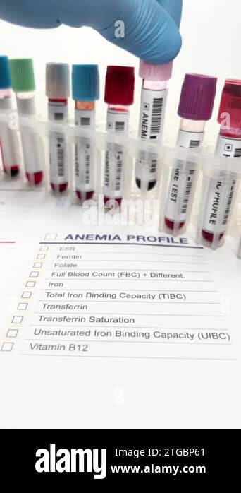 Anemia analysis Stock Videos & Footage - HD and 4K Video Clips - Alamy
