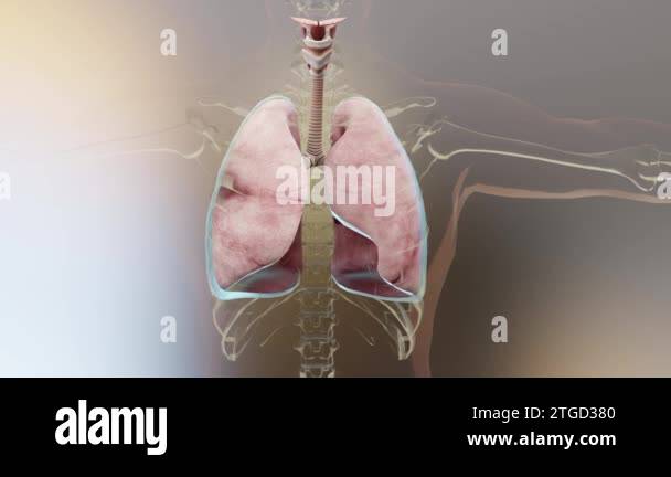 Pneumothorax, Hemothorax and Hemopneumothorax, Normal lung versus ...