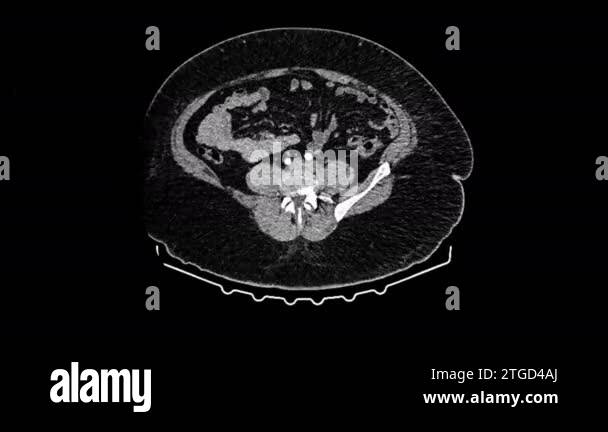 Magnetic resonance radiologist visualization, MRI scan on screen ...