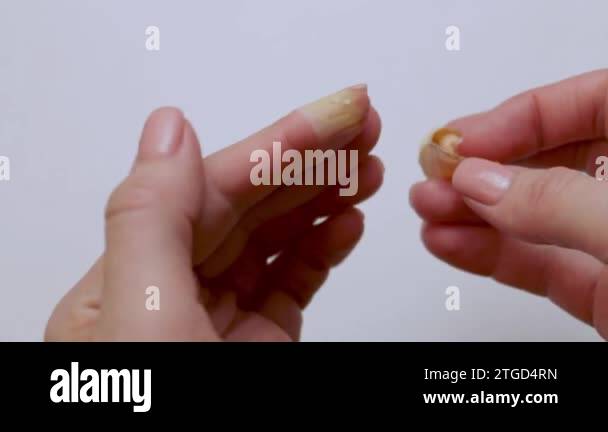 Wound on the finger of the hand after the band-aid. First aid for ...