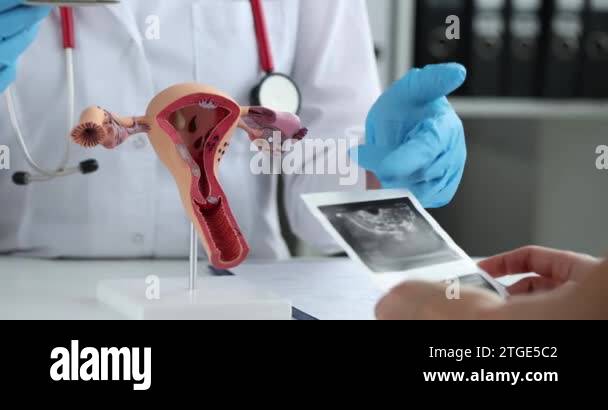 Gynecologist consulting woman with ultrasound scan of uterus in clinic ...