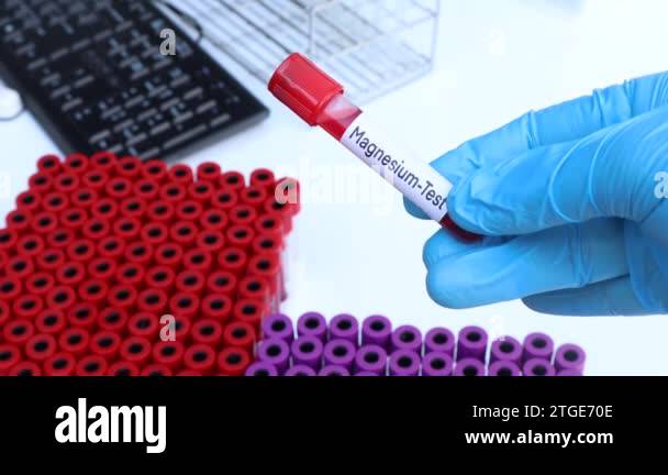 Magnesium test to look for abnormalities from blood, blood sample to ...