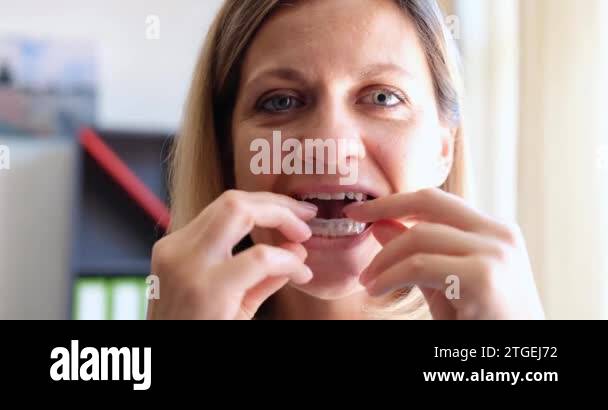 Bite caps Stock Videos & Footage - HD and 4K Video Clips - Alamy
