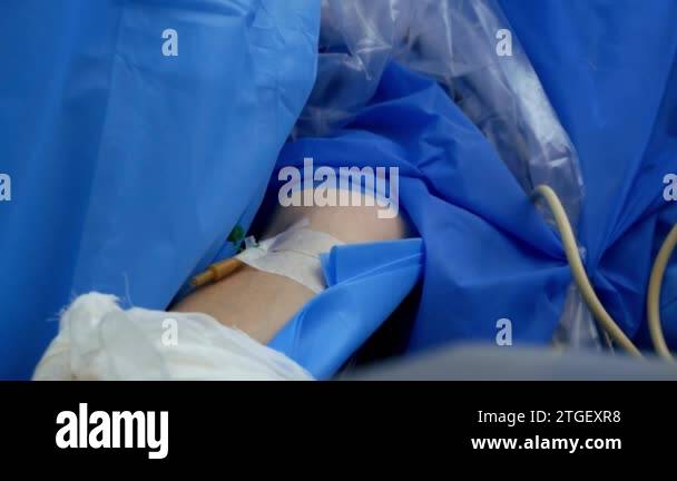 Close-up of a venous catheter in the arm of a patient under general ...