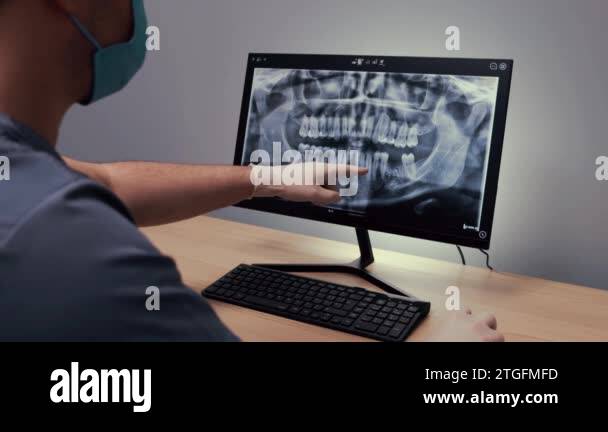 Dentist exam X-ray image in dental office Stock Video Footage - Alamy