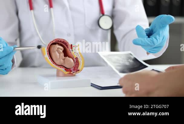 Doctor shows pregnant woman ultrasound scan and anatomy of baby fetus ...
