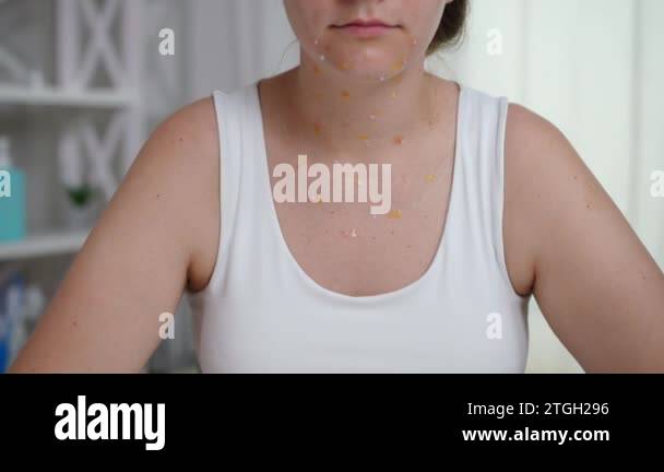 Dermatitis rash viral disease Stock Videos & Footage - HD and 4K Video ...