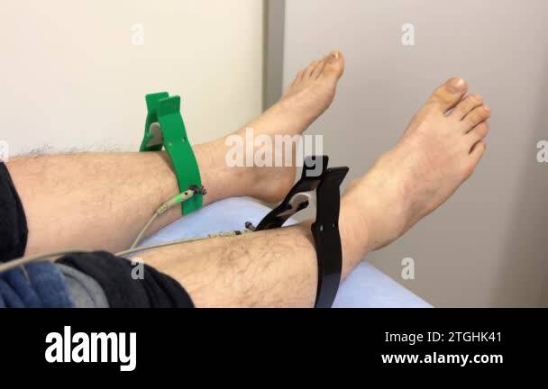 Electrode of ECG tracing of ill patient in the intensive care unit ECG ...