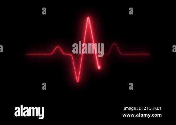 Heartbeat display animation 4k on motion graphics. Healtcare, medical ...