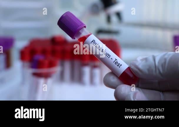 Potassium test to look for abnormalities from blood, blood sample to ...