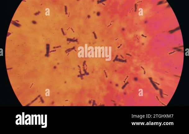 Orange microscope Stock Videos & Footage - HD and 4K Video Clips - Alamy