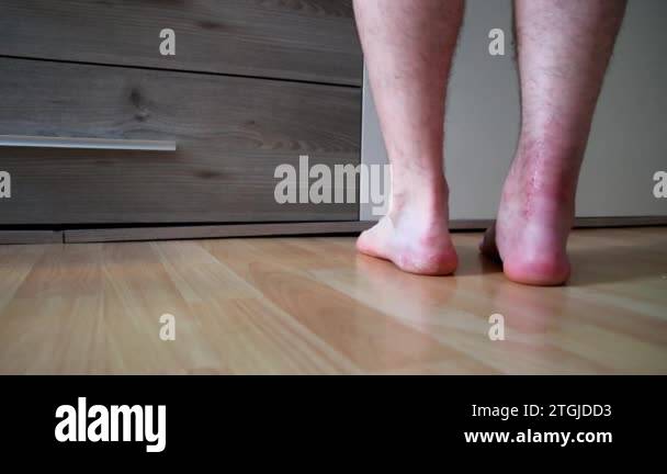 Achilles tendon operation Stock Videos & Footage - HD and 4K Video ...