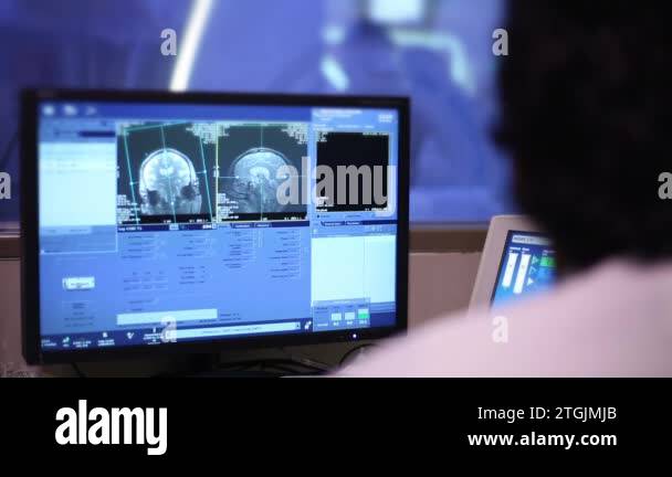 MRI research. Brain imaging. Pictures of the brain scan on the monitor ...