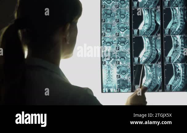 Roentgen check and roentgen Stock Videos & Footage - HD and 4K Video ...