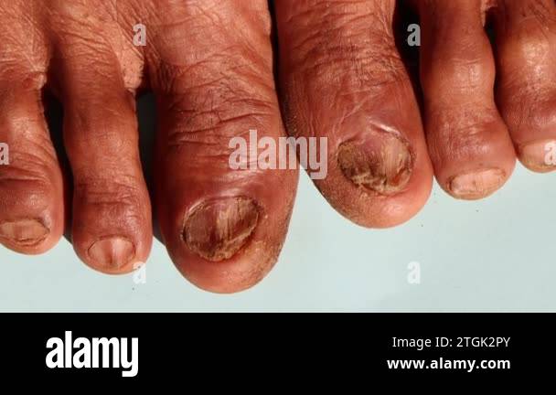 Human feet brown skin Stock Videos & Footage - HD and 4K Video Clips ...