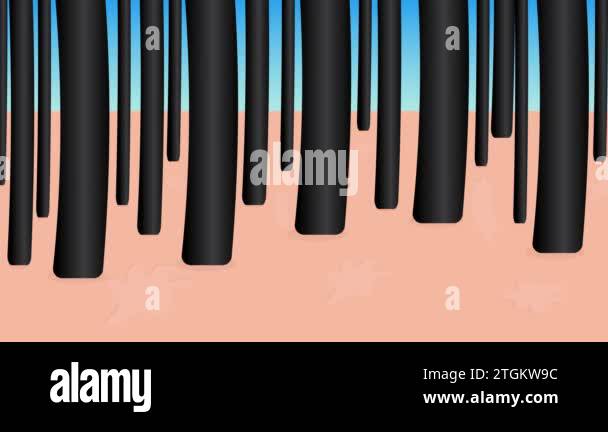 Dandruff growing on head skin with long hair 4K animation. Hair scalp ...