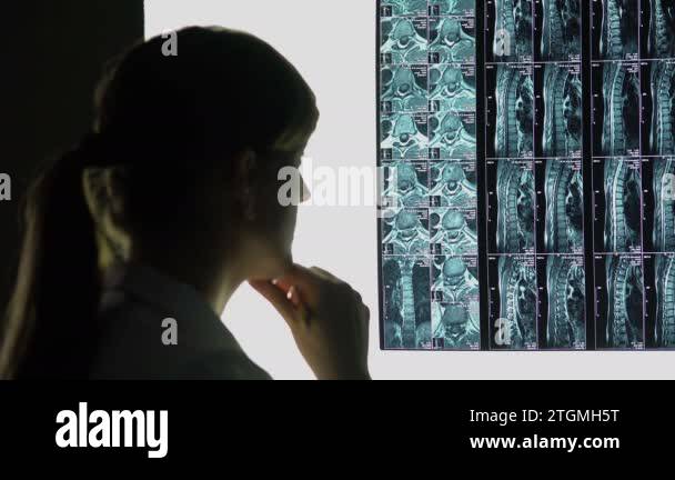 Rare case of spinal injury, doctor looking at patient's x-ray, making ...