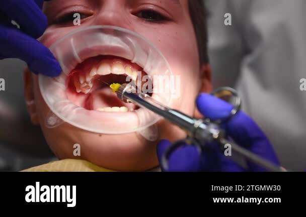 Close-up dentist using syringe with anesthetic, making injection of ...