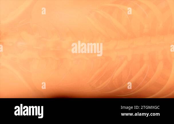 Peridural anaesthesia Stock Videos & Footage - HD and 4K Video Clips ...