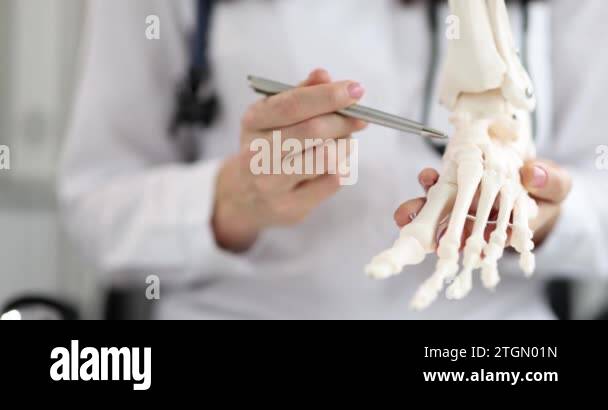 Orthopedic doctor looks at skeleton of ankle of foot. Gait disturbance ...