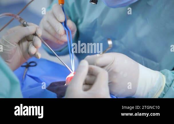 Functional rhinosurgery for the restoration of nasal breathing ...