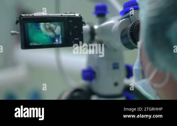 Close-up dental microscope screen with tooth cavity and blurred doctor ...